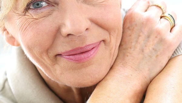 Surco Nasogeniano - Otium Clinics